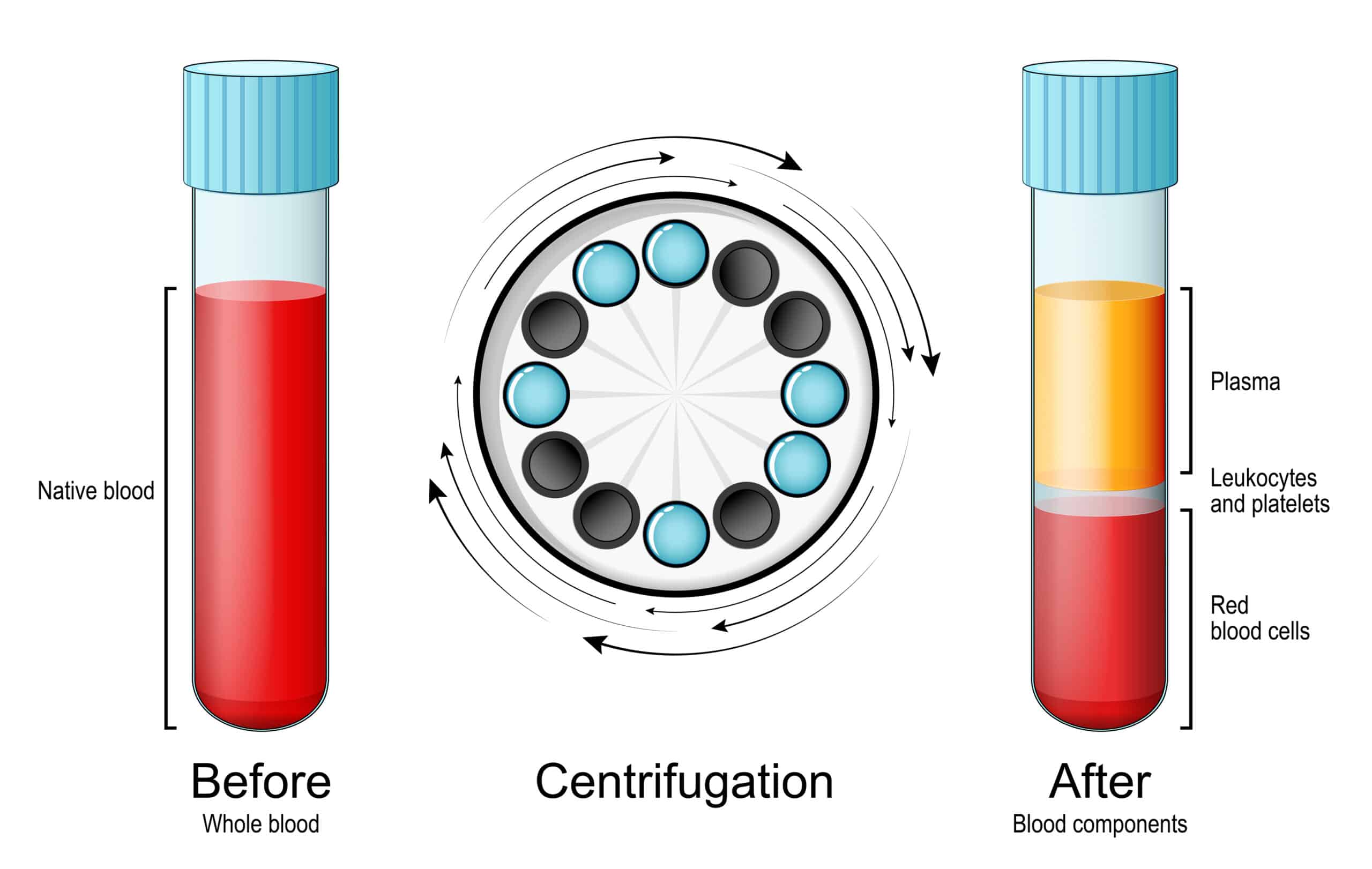FAQs About PRP for Foot & Ankle | Seaview Orthopaedic & Medical ...
